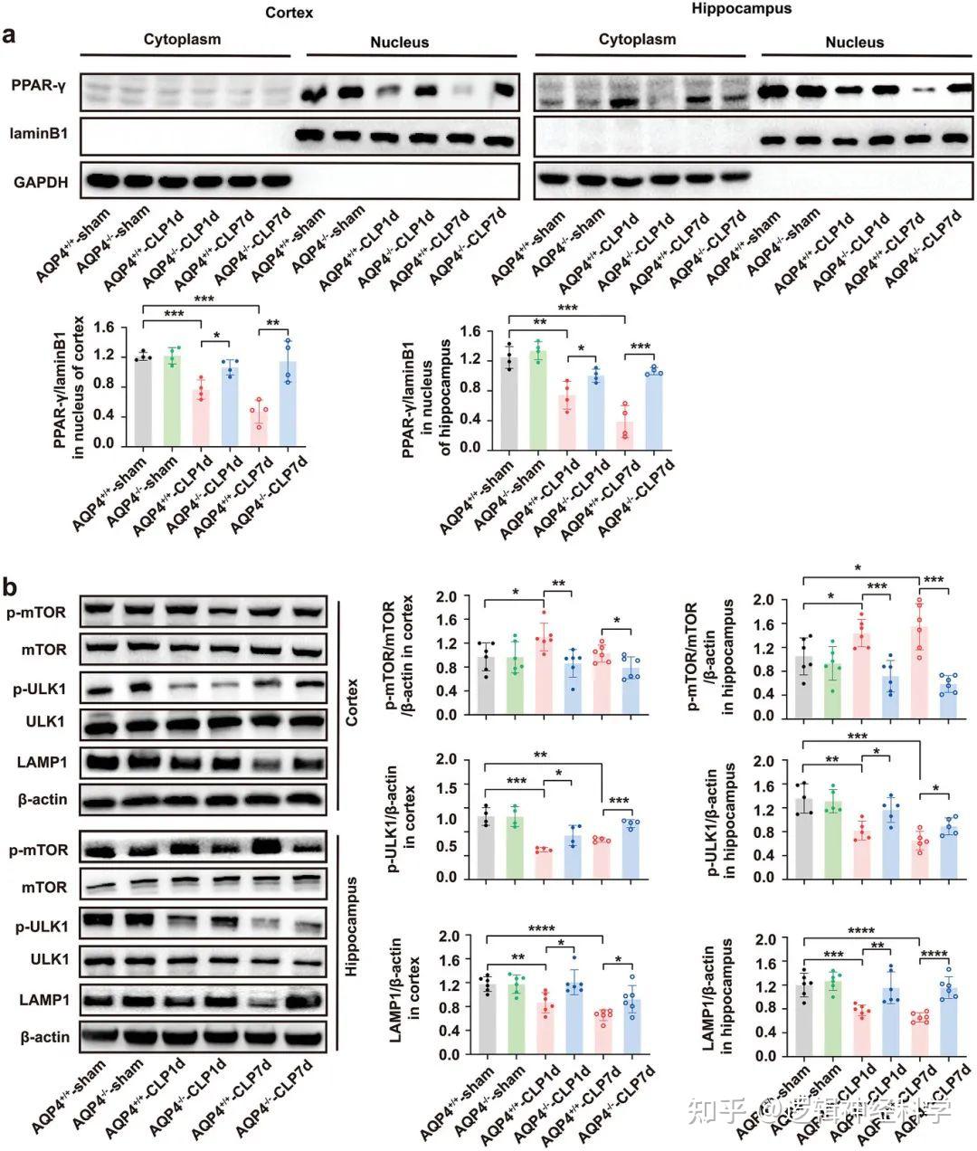 Adv Sci︱大连医科大学李韶课题组揭示AQP4通过抑制Nav1.6介导的星形胶质细胞自噬加重脓毒症相关脑病认知障碍 - 知乎