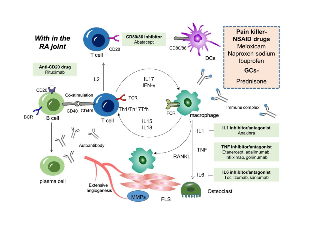 STTT 综述︱澳门科技大学朱依谆团队阐述类风湿性关节炎的新信号通路以及新靶点 - 知乎