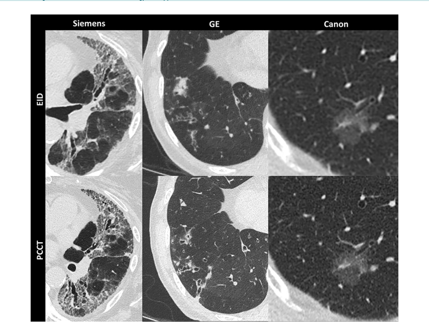 CT技术革命？一文读懂光子计数CT（PCCT）的前沿进展与临床潜力 - 知乎
