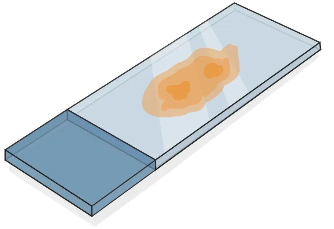 FFPE蛋白质组学分析|打开沉睡的样本库宝藏 - 知乎