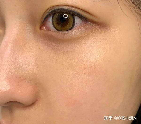 为啥我强烈建议想要快速美白时,一定要用涂抹式美白针?! 知乎
