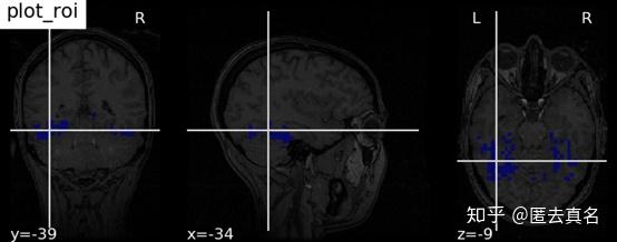 Nilearn：基于Python语言神经成像的机器学习（6） - 知乎
