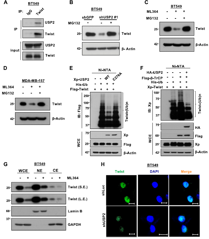 抑制USP2可消除癌症干细胞并增强TNBC对化疗的反应 - 知乎