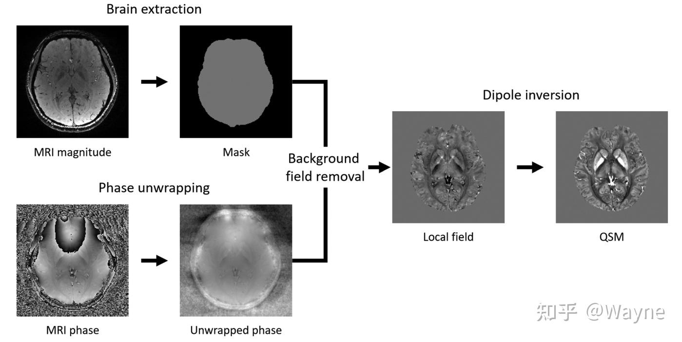 深度学习在QSM中的应用 - 知乎