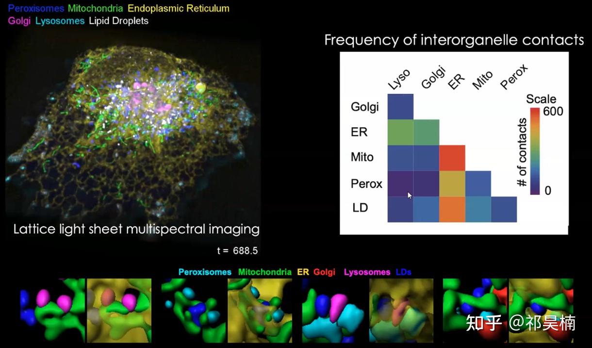 光镜电镜成像领域世界级大佬-Jennifer Lippincott Schwartz - 知乎