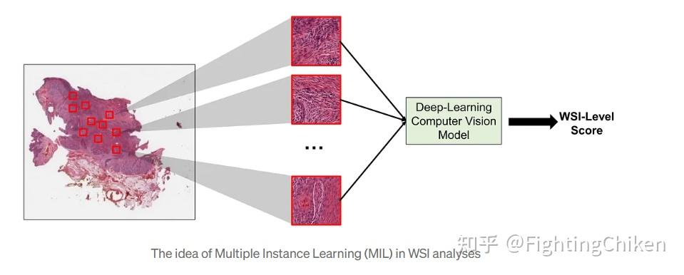 Multiple instance learning(MIL) - 知乎