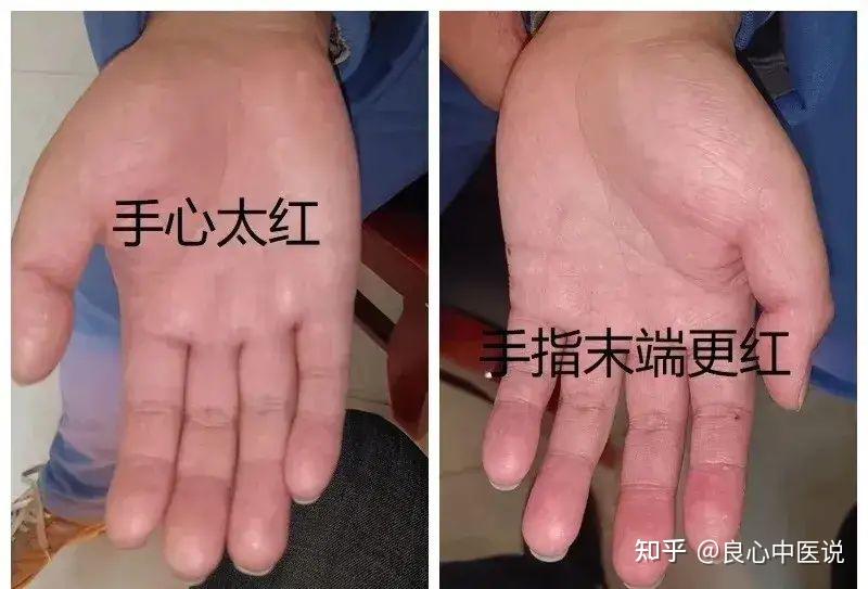 望闻问切辨手淫 知乎 9769