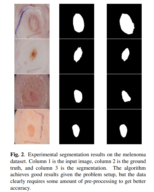现在做医学图像分割还是用Unet 作为基础网络吗？医学图像分割的趋势是什么？ - 知乎