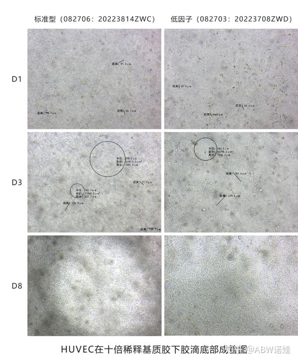 【每周质检】模基基质胶评测：HUVEC细胞成管实验 - 知乎