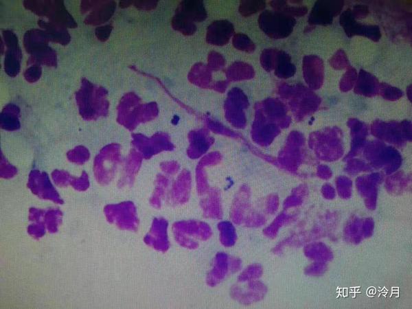 犬传染性肝炎(CAV) - 知乎