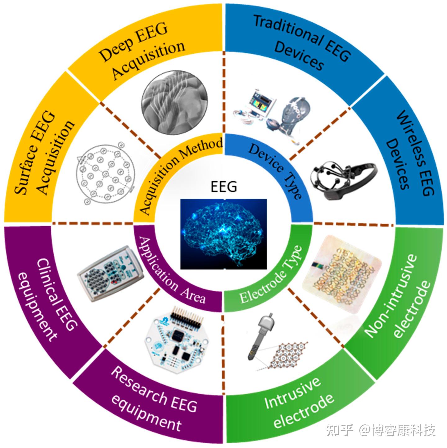 脑电设备：脑电图采集与反馈技术的应用与发展 - 知乎
