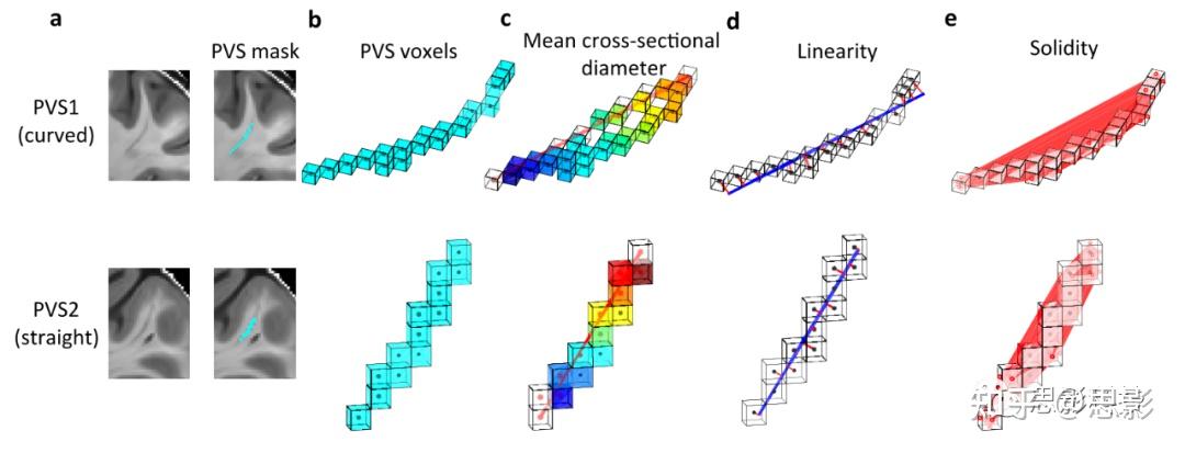 PVS：对血管周围间隙结构和功能的成像 - 知乎
