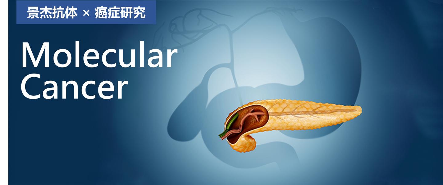 Mol Cancer | 北大团队揭示糖酵解-乳酸化修饰正反馈调节驱动PDAC进展的新机制 - 知乎