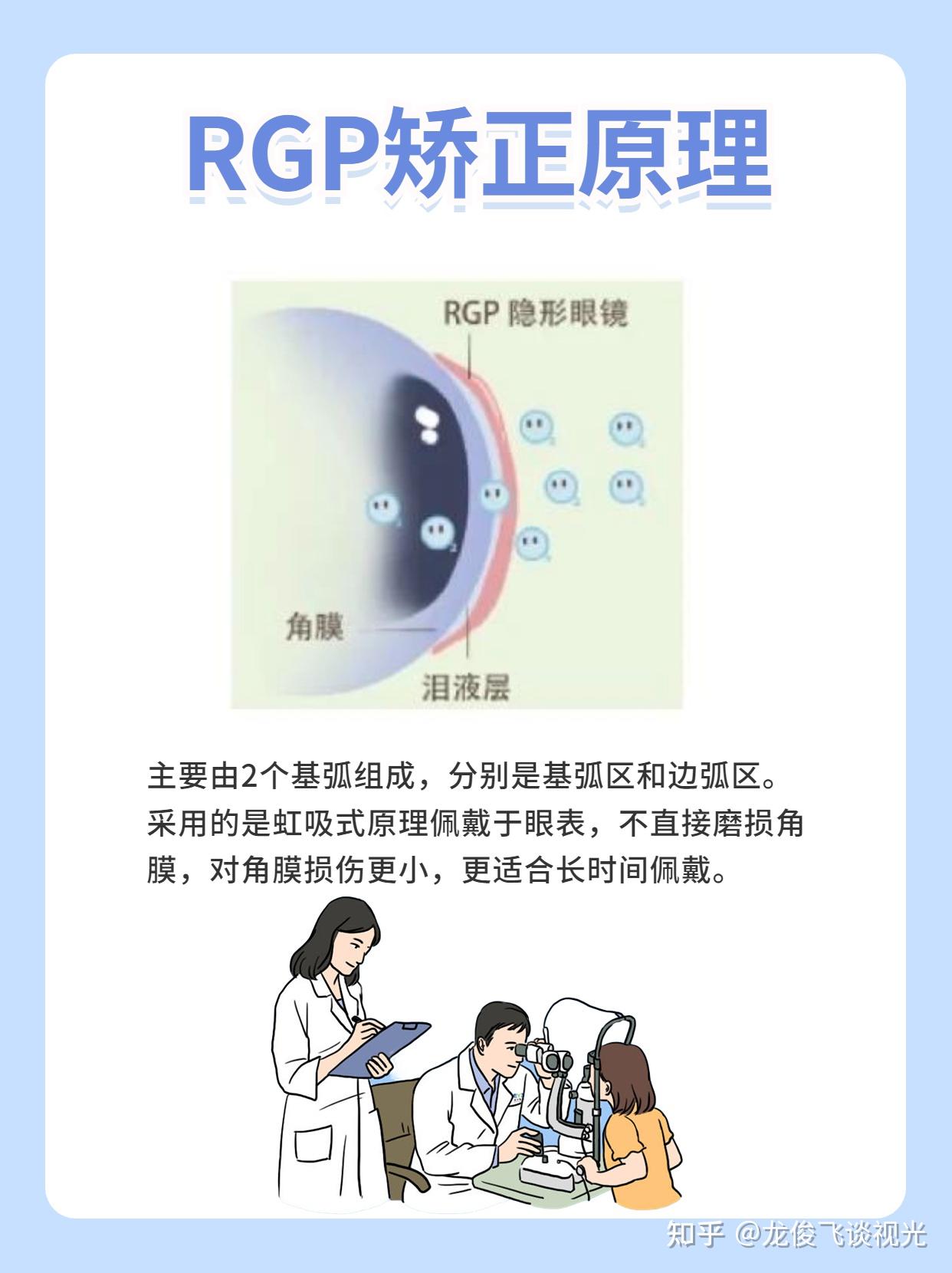 新手攻略｜RGP品牌对比，哪个性价比高 - 知乎