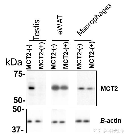 Int J Mol Sci｜多组学揭示MCT2限制肺癌小鼠模型中的肿瘤生长 - 知乎