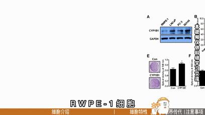 RWPE-1细胞培养，人前列腺正常细胞培养攻略 - 丰晖生物 - 知乎