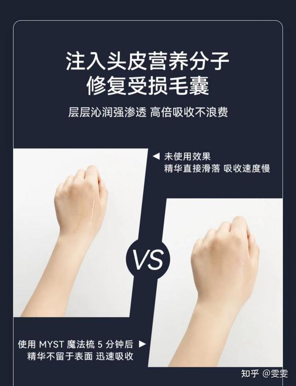 MYST魔法梳入坑指南：头皮养护和防脱生发必看！ - 知乎