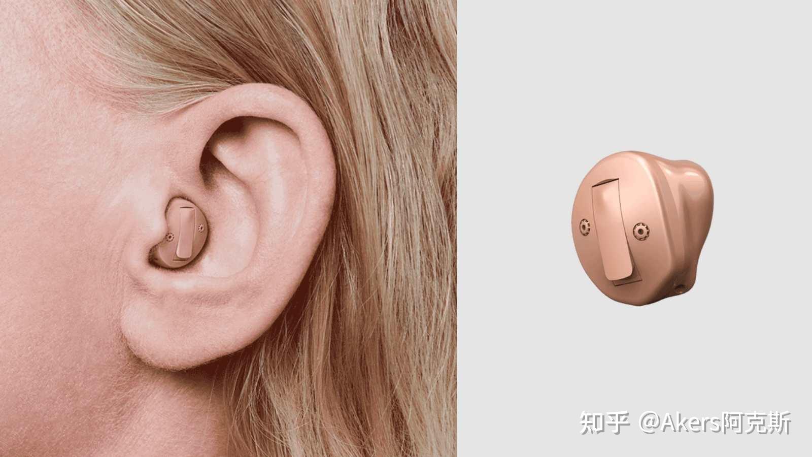 助听器外形全解析：RIC、BTE、IIC、ITE、CIC、TWS、OWS及颈挂式对比图解 - 知乎