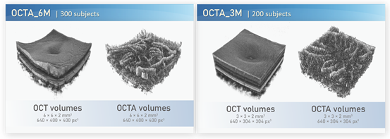 80GB医学影像数据集！OCTA-500公开发布 - 知乎