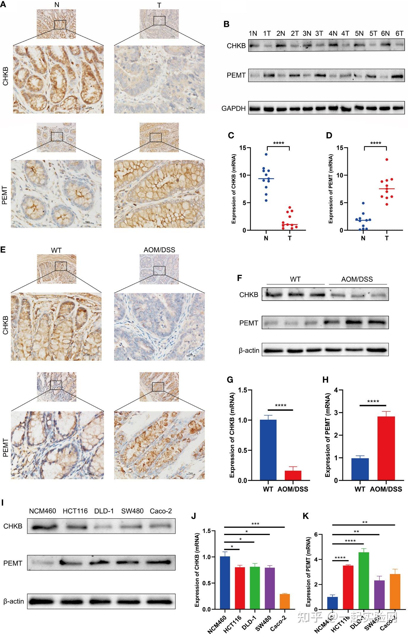 8+！胆碱代谢方向，构建癌症预后模型 - 知乎