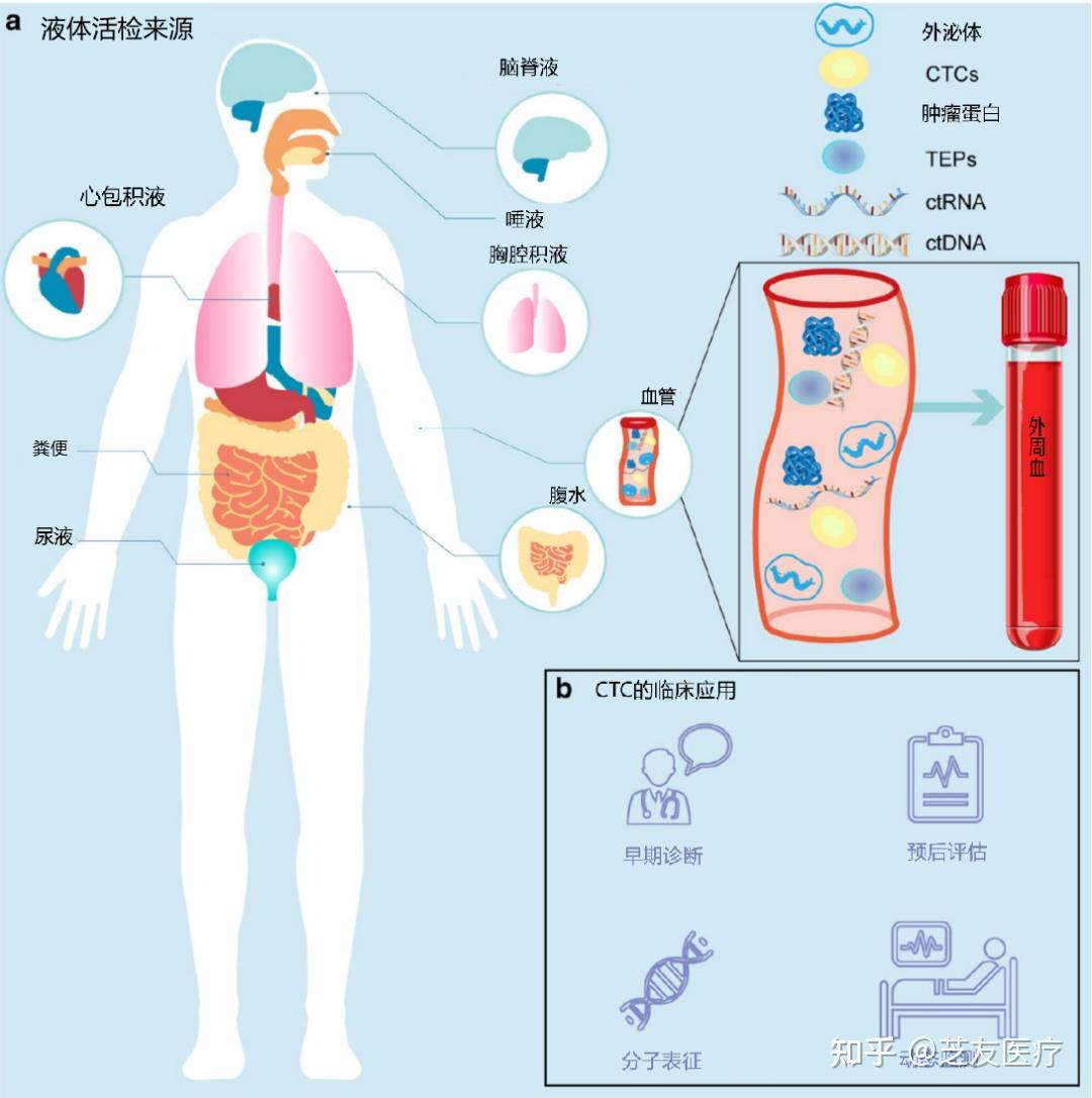 精准肿瘤中的CTC在液体活检和3D类器官模型中的临床应用 - 知乎