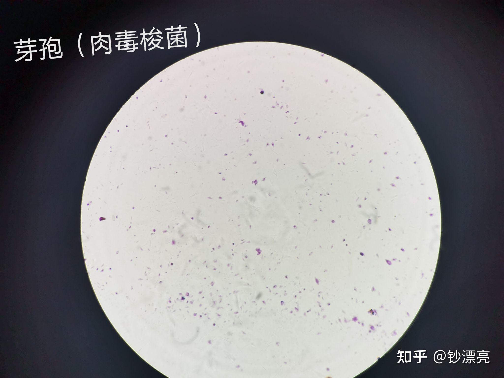 微生物显微镜🔬下观察 - 知乎