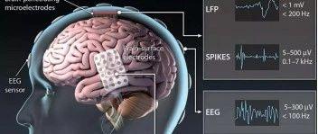 脑电系列第一期：初识脑电，EEG与ERP的关系 - 知乎