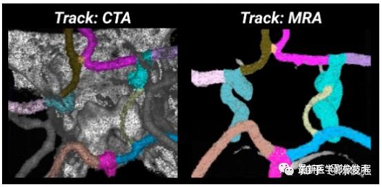 Top_Cow 2023——CTA和MRA的Willis环血管拓扑解剖结构分割解决方案分享 - 知乎