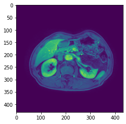 Python中nibabel(nib)和SimpleITK(sitk)在处理nifty文件时候的差异 - 知乎