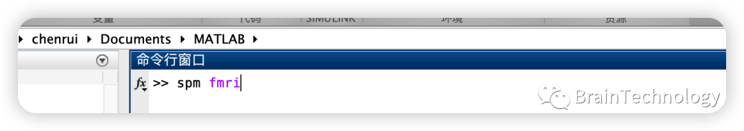 LIONirs：一款基于SPM灵活用于分析近红外数据的MATLAB工具箱 - 知乎