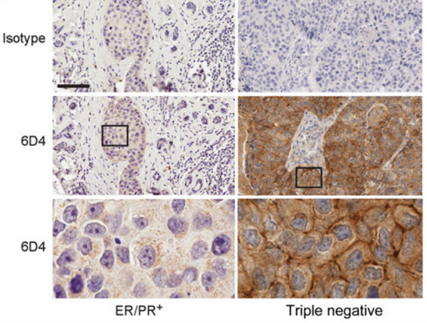 杰论系列 | 肿瘤免疫治疗新兴靶点ROR1 - 知乎