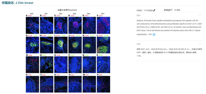 石蜡切片免疫荧光双标-TSA - 知乎