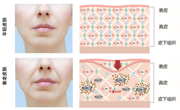 聚焦细胞老化研究，SASP因子再受关注 - 知乎