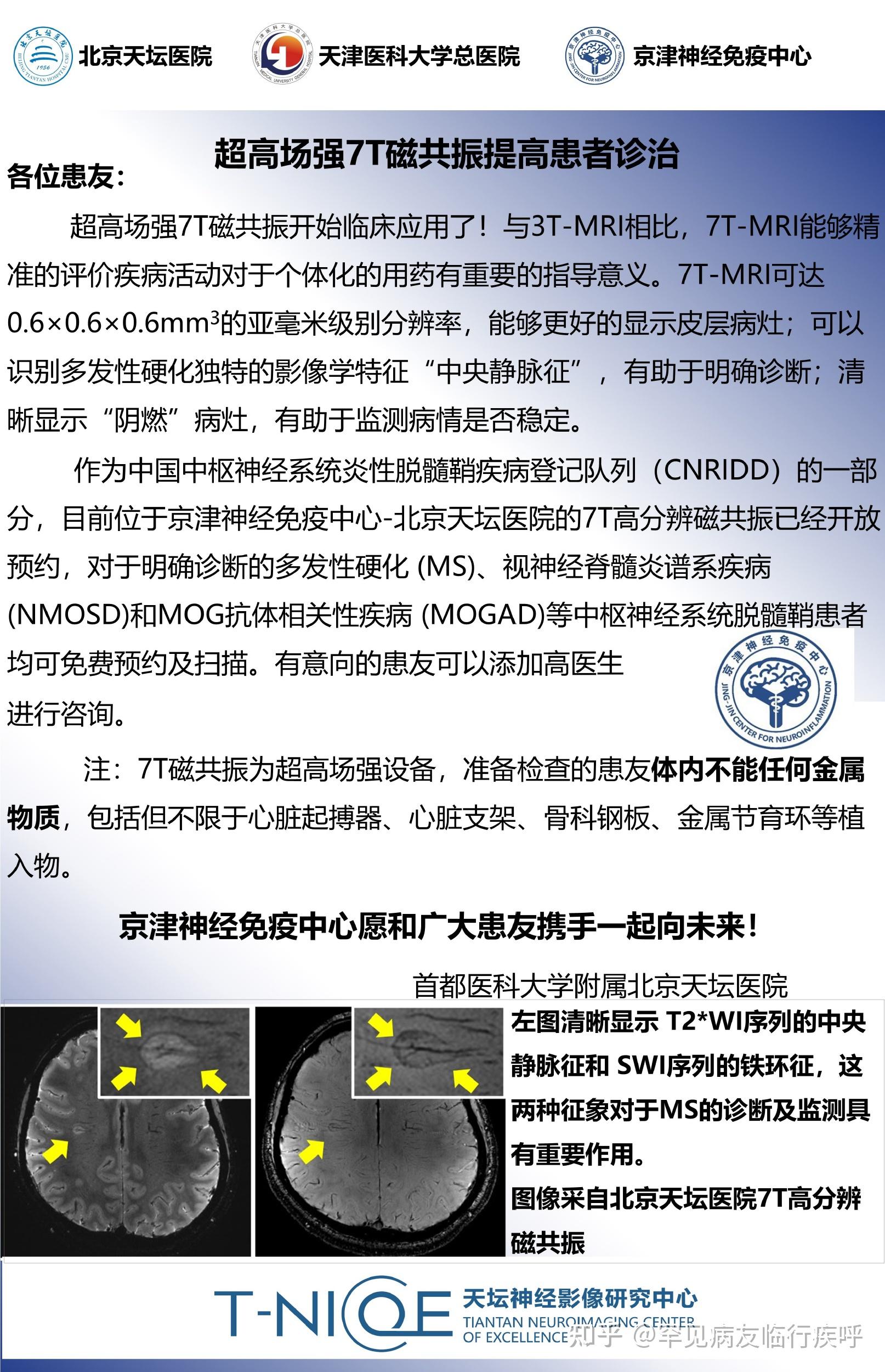 北京7T MRI（超高场强磁共振）科研在哪谁能参加？注意事项？7T磁共振和3T、1.5T MRI区别？ - 知乎