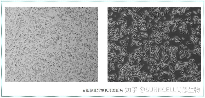 VCaP细胞培养注意事项 - 知乎