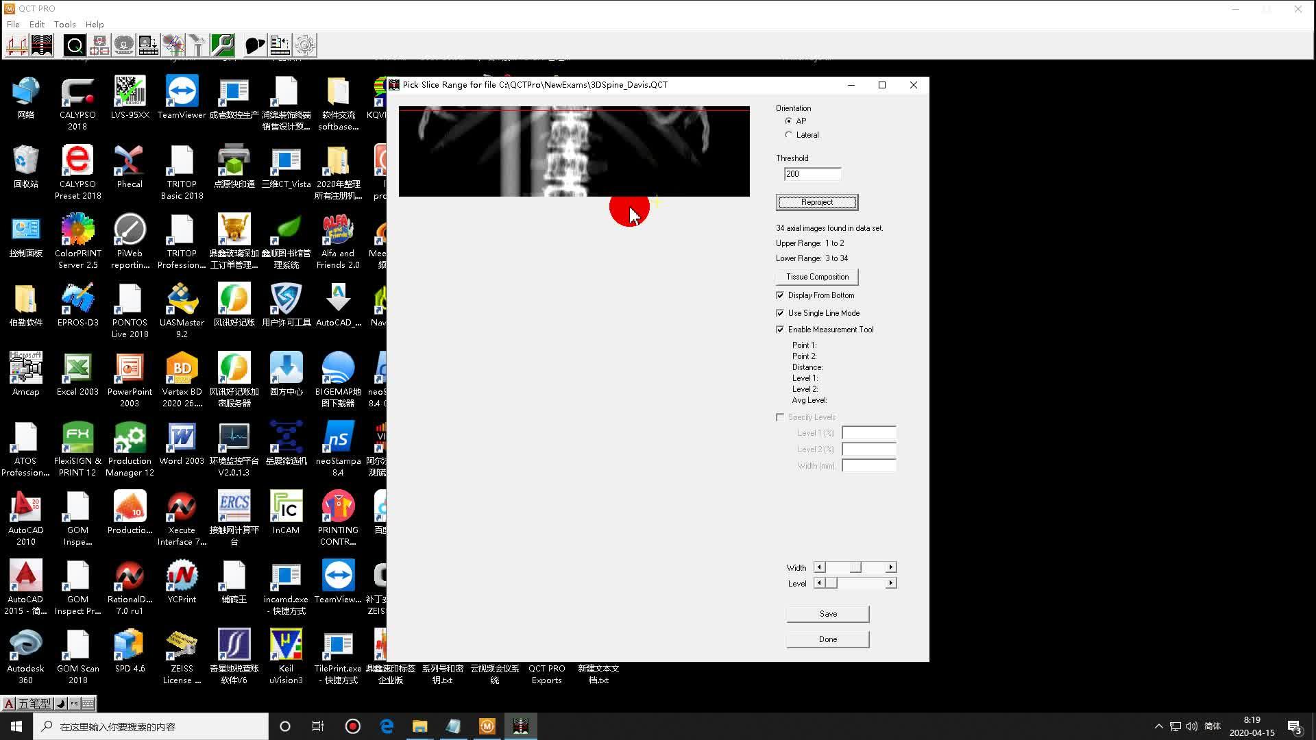 美国明维思Mindways QCT骨密度测量分析体模系统 - 知乎