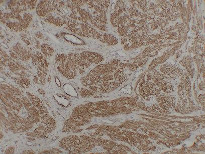 抗原抗体/IHC抗体/Caldesmon (3A10) mouse mAb - 知乎