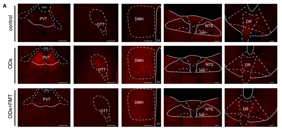 Cell子刊 | 压力一大就想狂吃狂喝？研究者终于揪出了背后元凶！ - 知乎