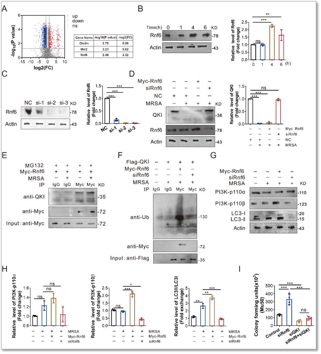 Cell Biosci︱空军军医大学汪莉/卢兹凡团队发现RNA结合蛋白QKI有望成为治疗MRSA感染的新靶点 - 知乎