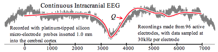 万亿级时序搜索问题的加速技巧 -- UCR DTW 论文解读 & Python复现 - 知乎