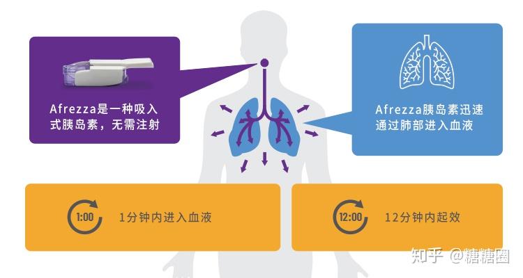 新型胰岛素 | 吸入胰岛素粉雾剂Afrezza，一文带你了解 - 知乎