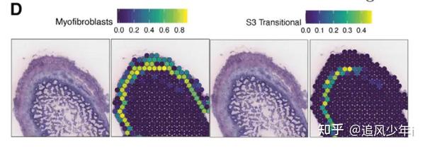10X空间转录组重点分析合集 - 知乎