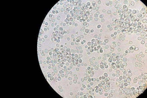 在普通光学显微镜下观察酵母菌可以看到那些结构？ - 知乎