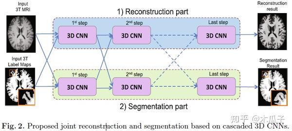医学图像MRI增强相关论文 - 知乎