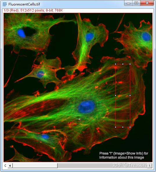 ImageJ实用技巧——荧光共定位分析(定量分析篇) - 知乎