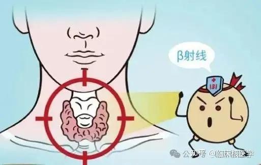 碘-131治疗科普：常见问题解答 - 知乎
