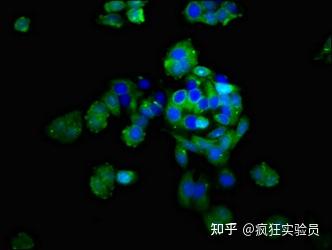DSG2：桥粒芯蛋白家族DSGs表达最广泛的成员，心肌病、腺病毒和肿瘤新兴靶点？ - 知乎