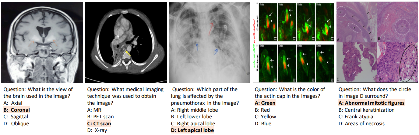PMC-VQA 数据集介绍 - 知乎