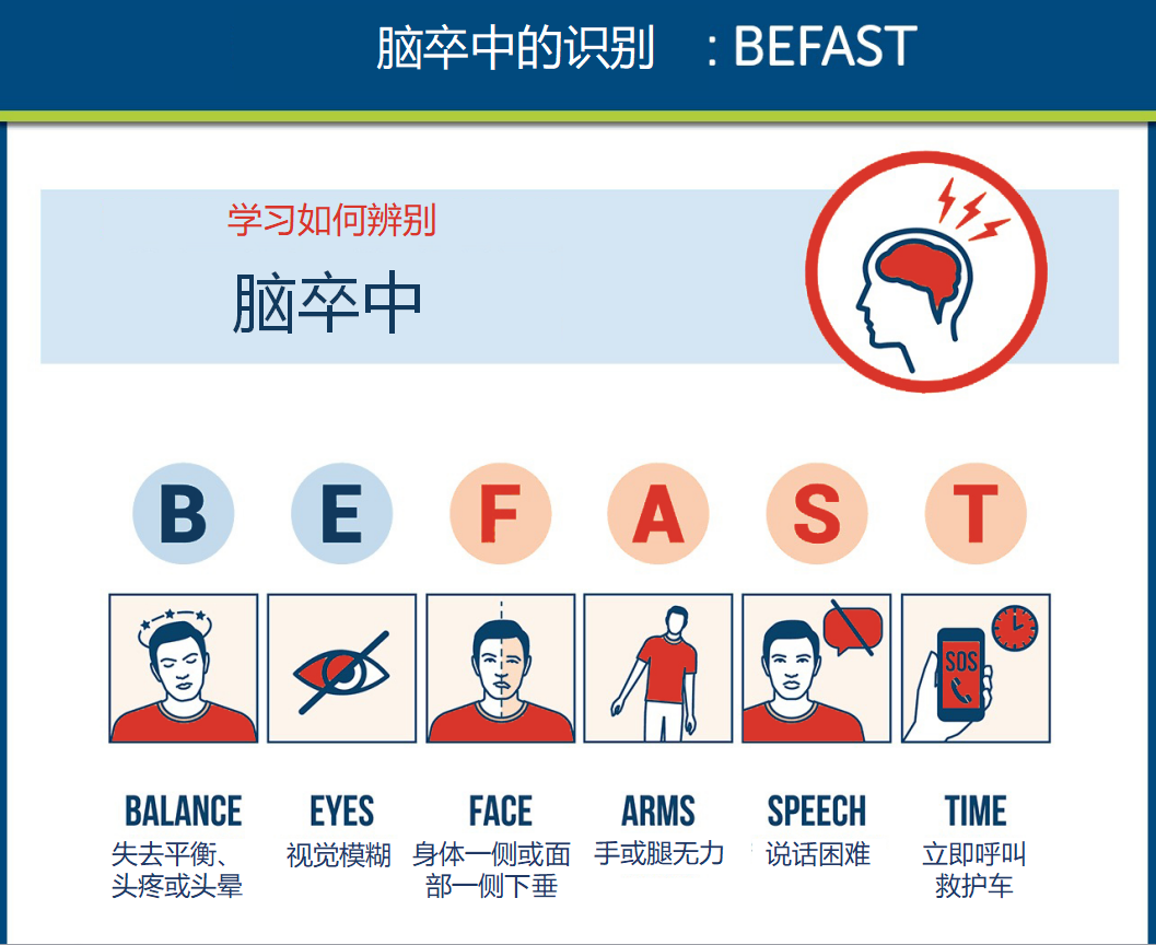 卒中急救又提速！入院到溶栓：30分钟 - 知乎