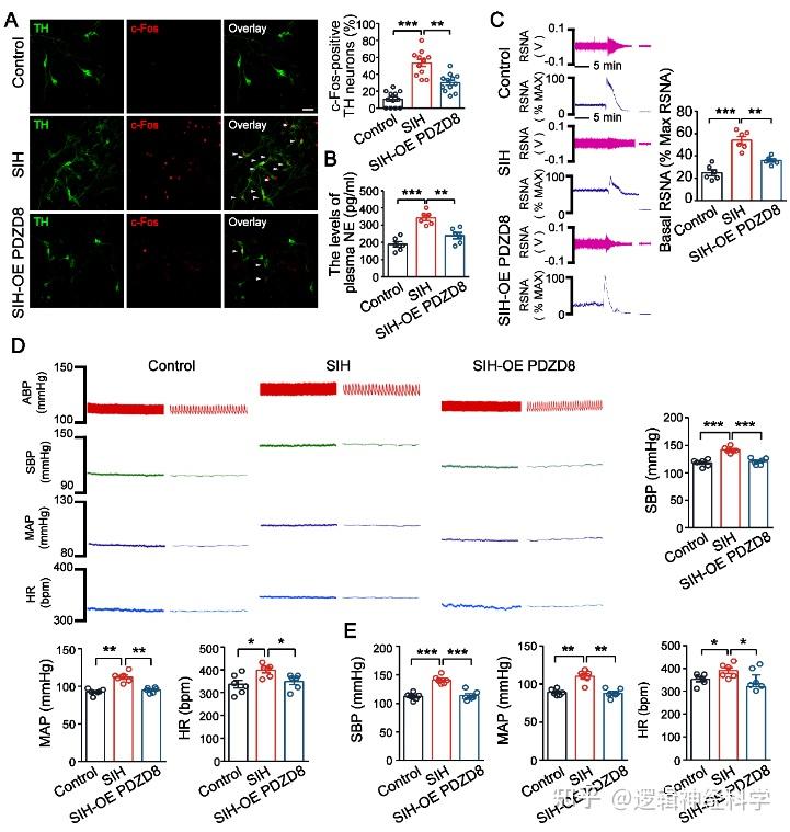 Neurobiol Dis︱上海大学杜东书/张帅团队揭示PDZD8介导RVLM神经元内质网线粒体互作对应激性高血压作用 - 知乎